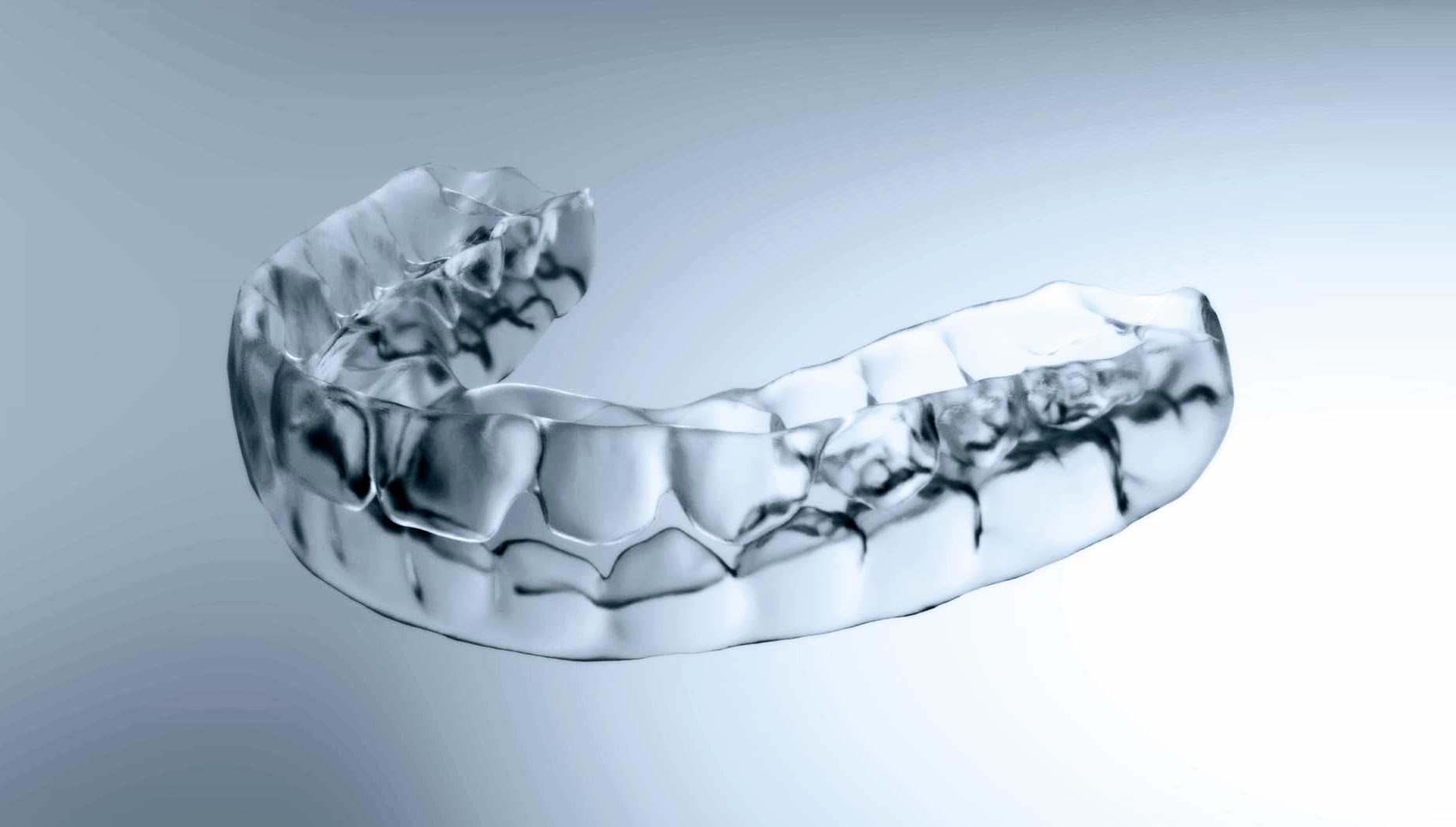 Tooth positioner individualisés imprimés en direct. - AFOND.FR